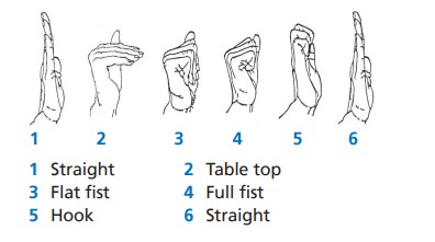 Soft Tissue Injury / Sprain Wrist - The Dudley Group NHS Foundation Trust