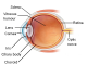 Eye problems – uveitis - The Dudley Group NHS Foundation Trust